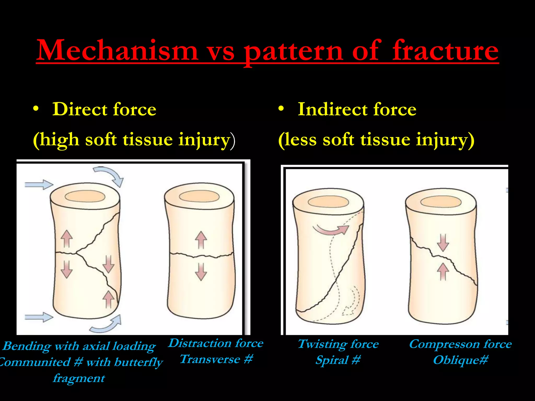 Fracture classification, healing | PPTX