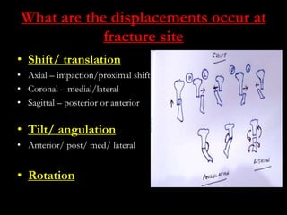 Fracture classification, healing | PPTX
