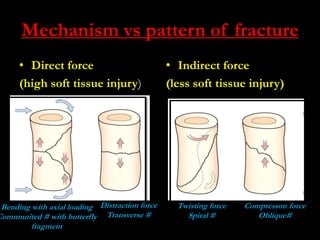 Fracture classification, healing | PPTX