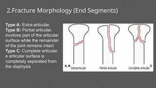 Fracture classification rockwood as source.pptx