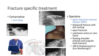 Fracture clavicle.pptx