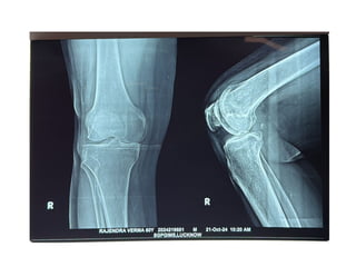 ewfwef ewfwevfwf grtbetet ergwrgwgwggwewge wrgwrgwrgwg | PPT