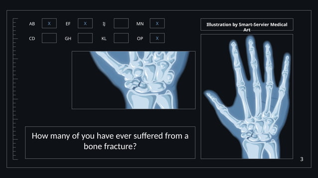 Fractured Bone Case Study by Slidesgo.pptx
