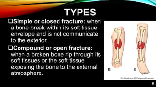 Fracture Description by Nihinlola (BPT part 4) | PPTX