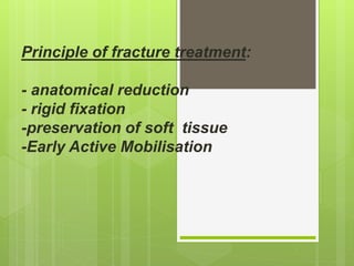 Fracture disease | PPTX