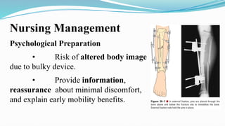 Fracture Fixation.Cast. Musculoskeletal and Orthopedic Nursing ...