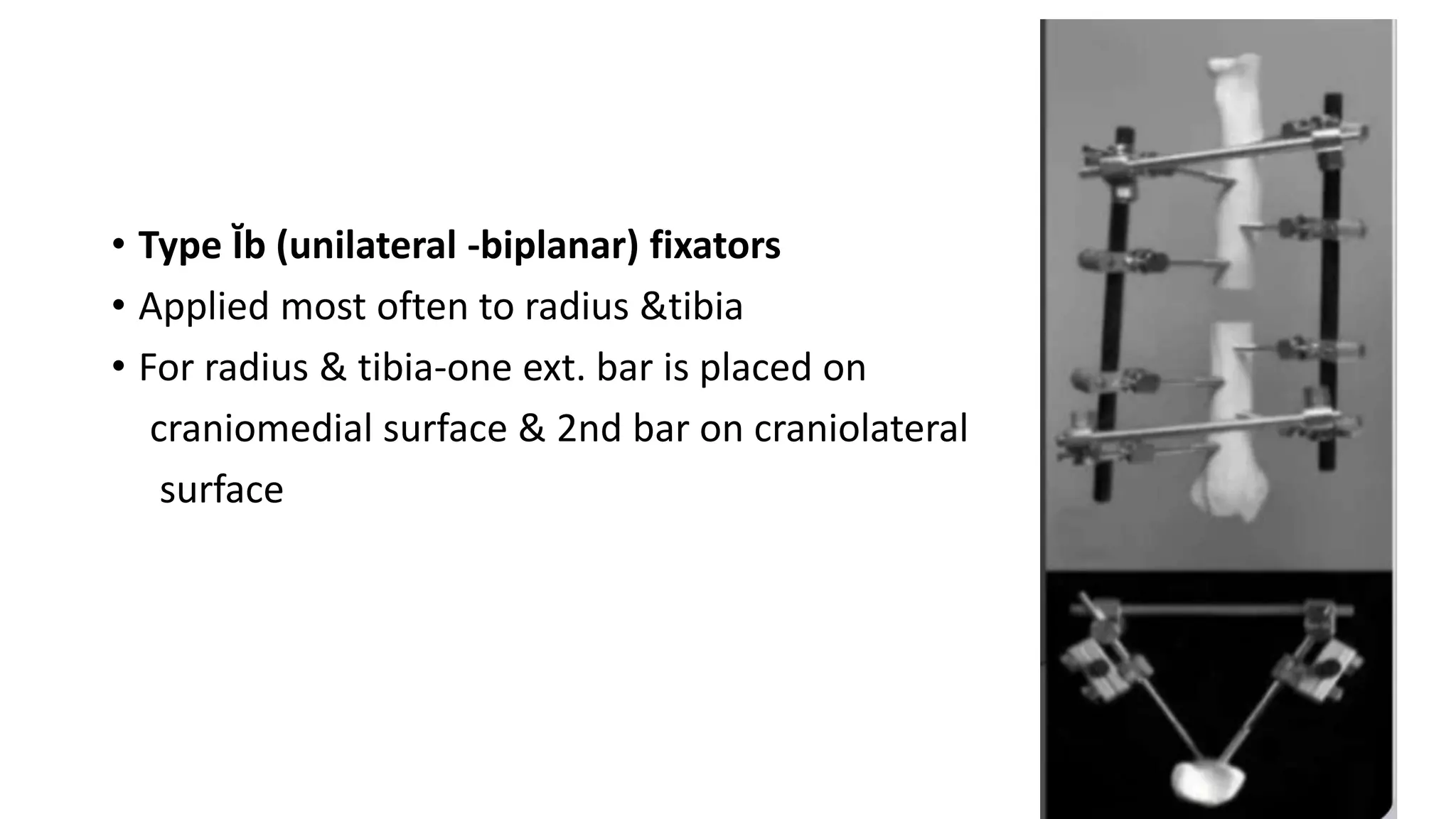 Fracture Fixation Techniques.pptx