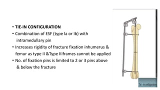 Fracture Fixation Techniques.pptx