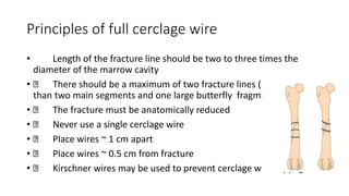 Fracture Fixation Techniques.pptx