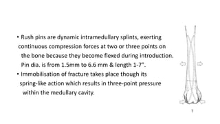 Fracture Fixation Techniques.pptx