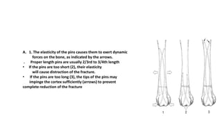 Fracture Fixation Techniques.pptx
