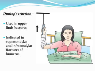 FRACTURE – GENERAL MANAGEMENT AND COMPLICATIONS.pptx