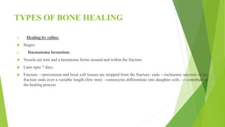 Fracture healing | PPTX