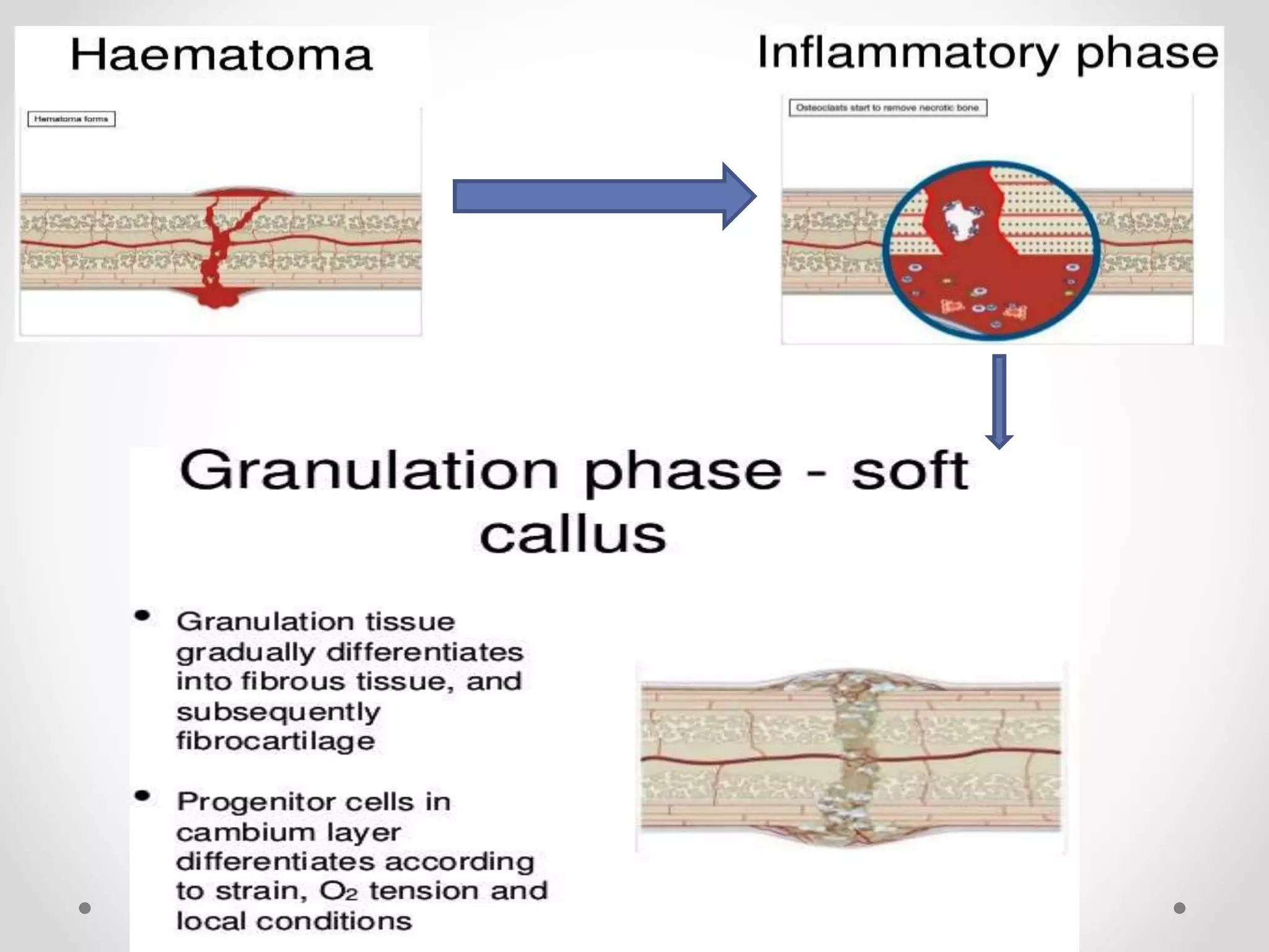 Bone biology and principle of bone healing. | PPT