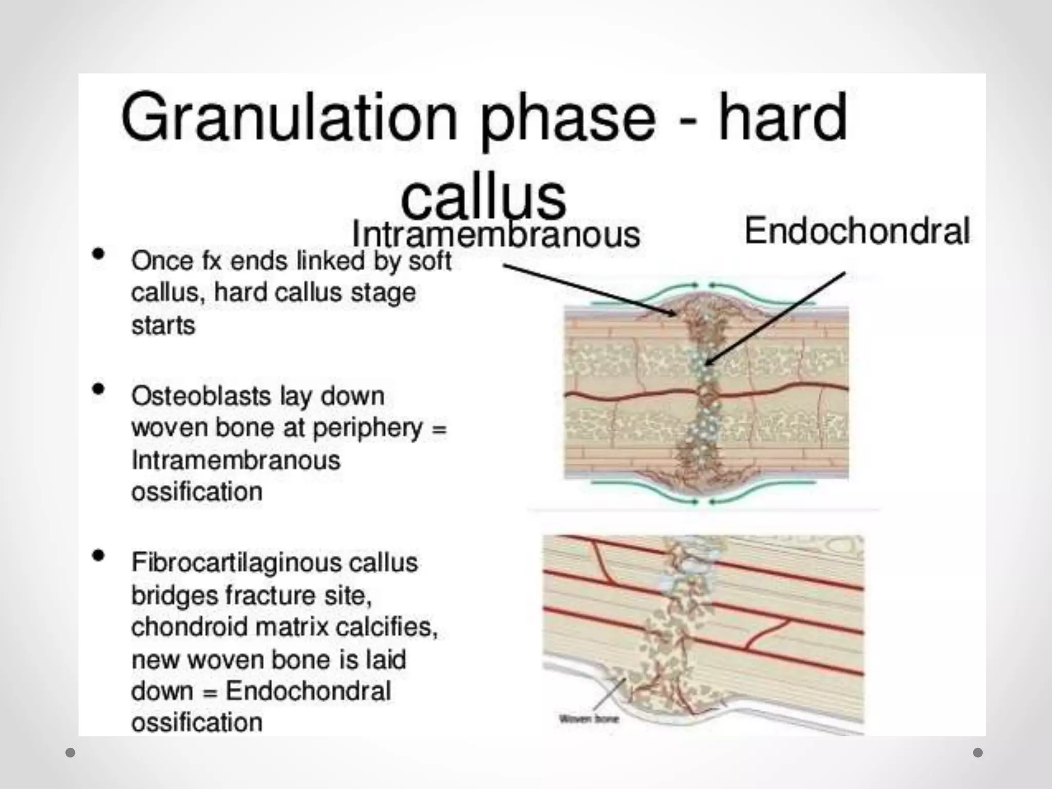 Bone biology and principle of bone healing. | PPT