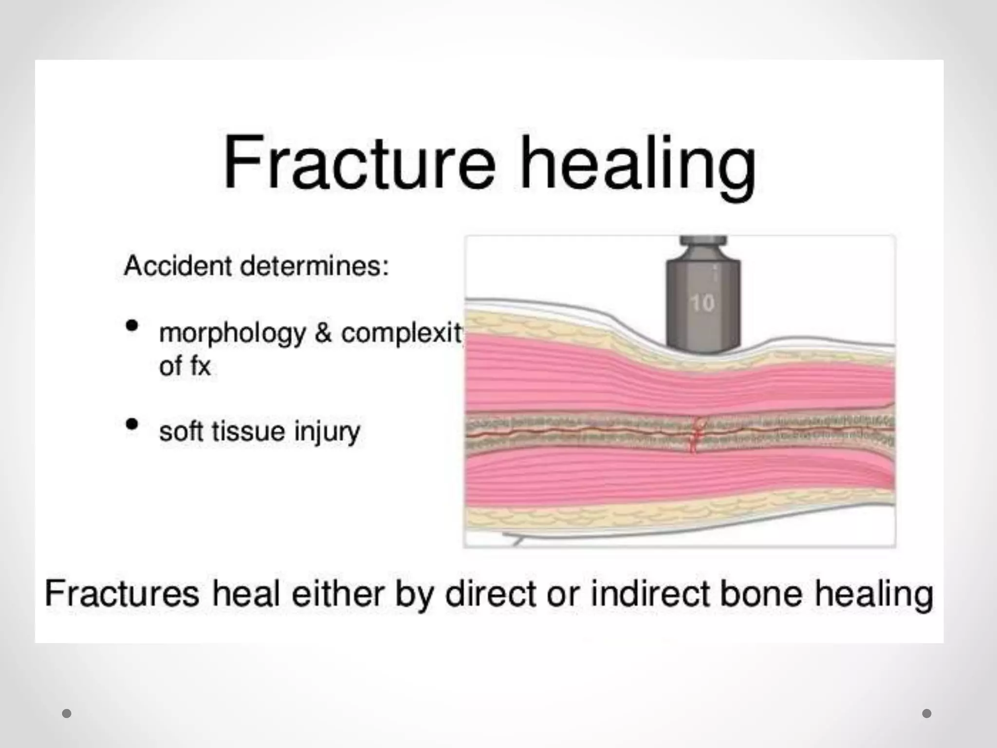 Bone biology and principle of bone healing. | PPT