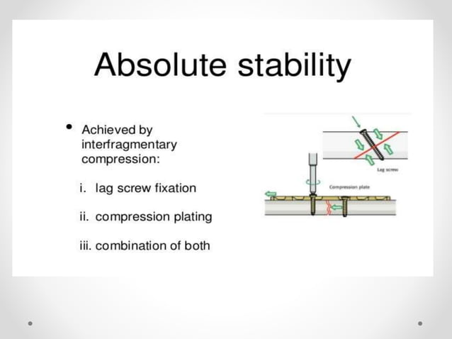 Bone biology and principle of bone healing. | PPT
