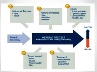 Bone biology and principle of bone healing. | PPT