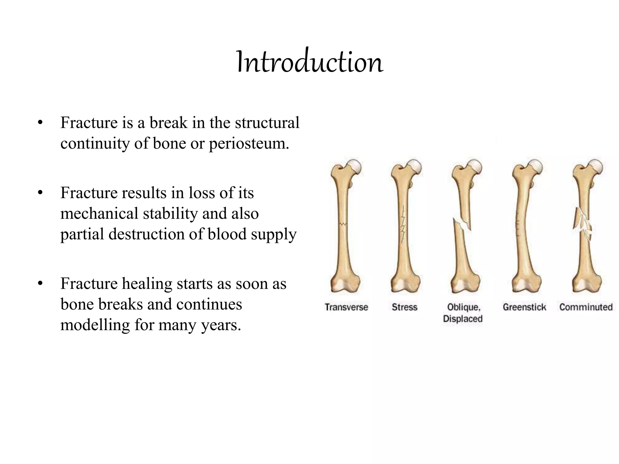 Fracture healing | PPTX