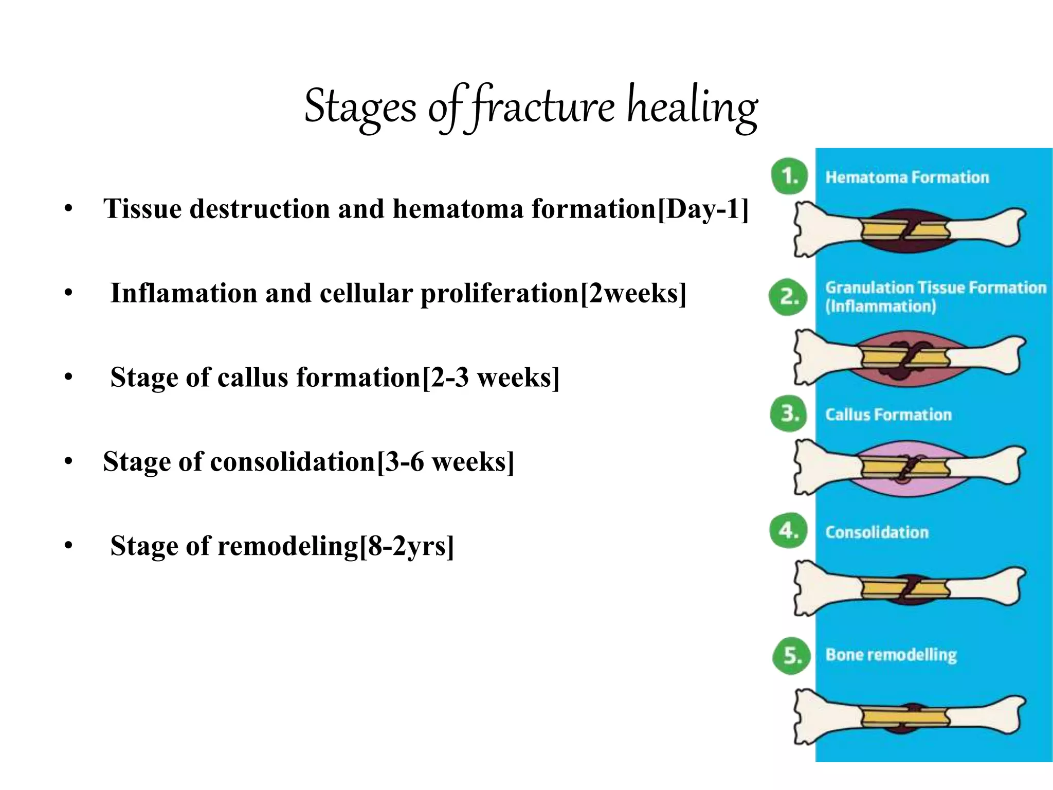 Fracture healing | PPTX