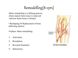 Fracture healing | PPTX