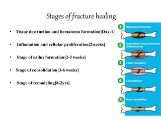 Fracture healing | PPT