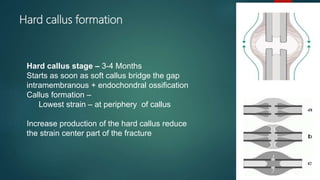 Fracture Healing.pptx