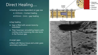 Fracture Healing.pptx
