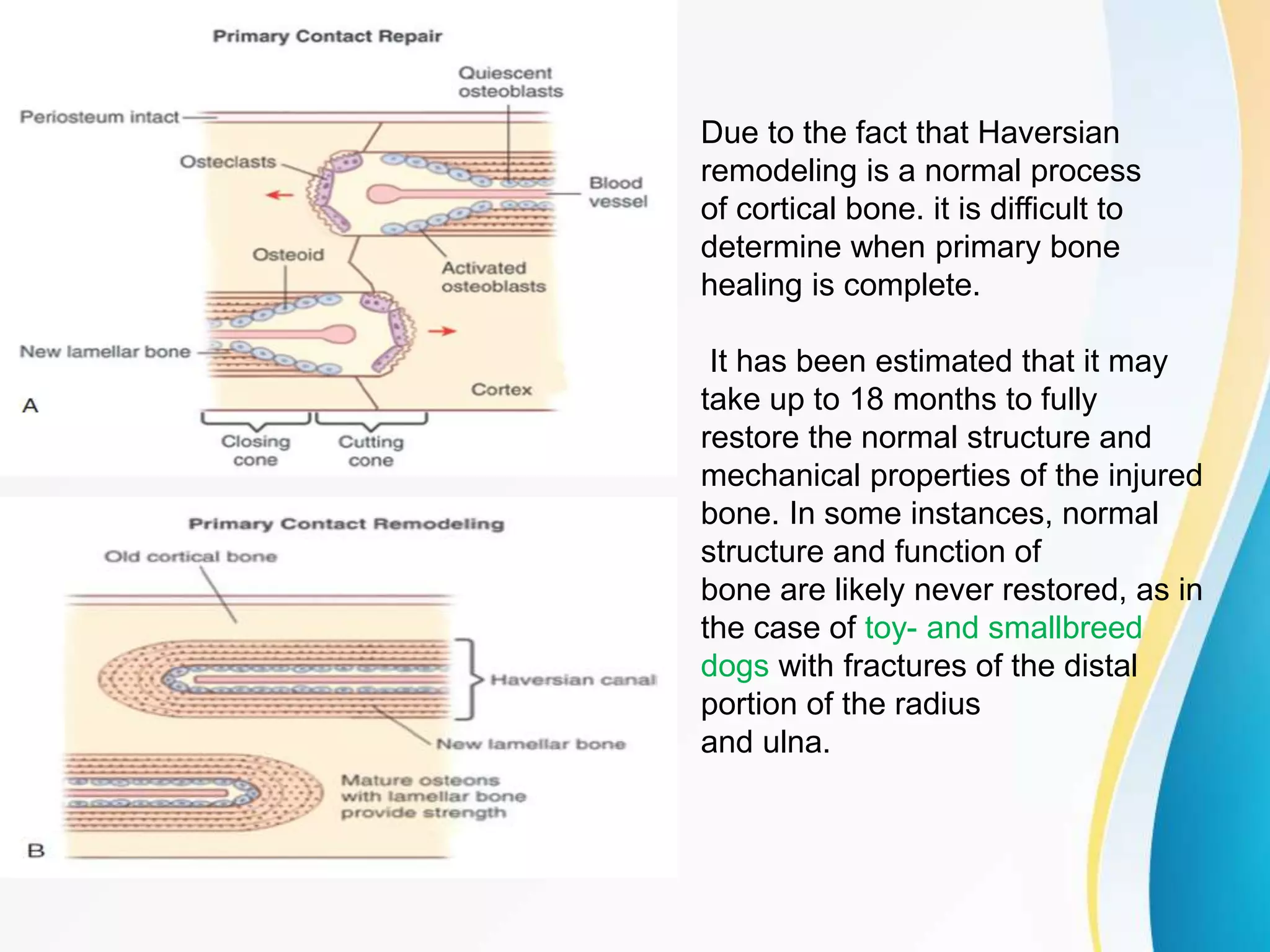 Fracture Healing.pptx