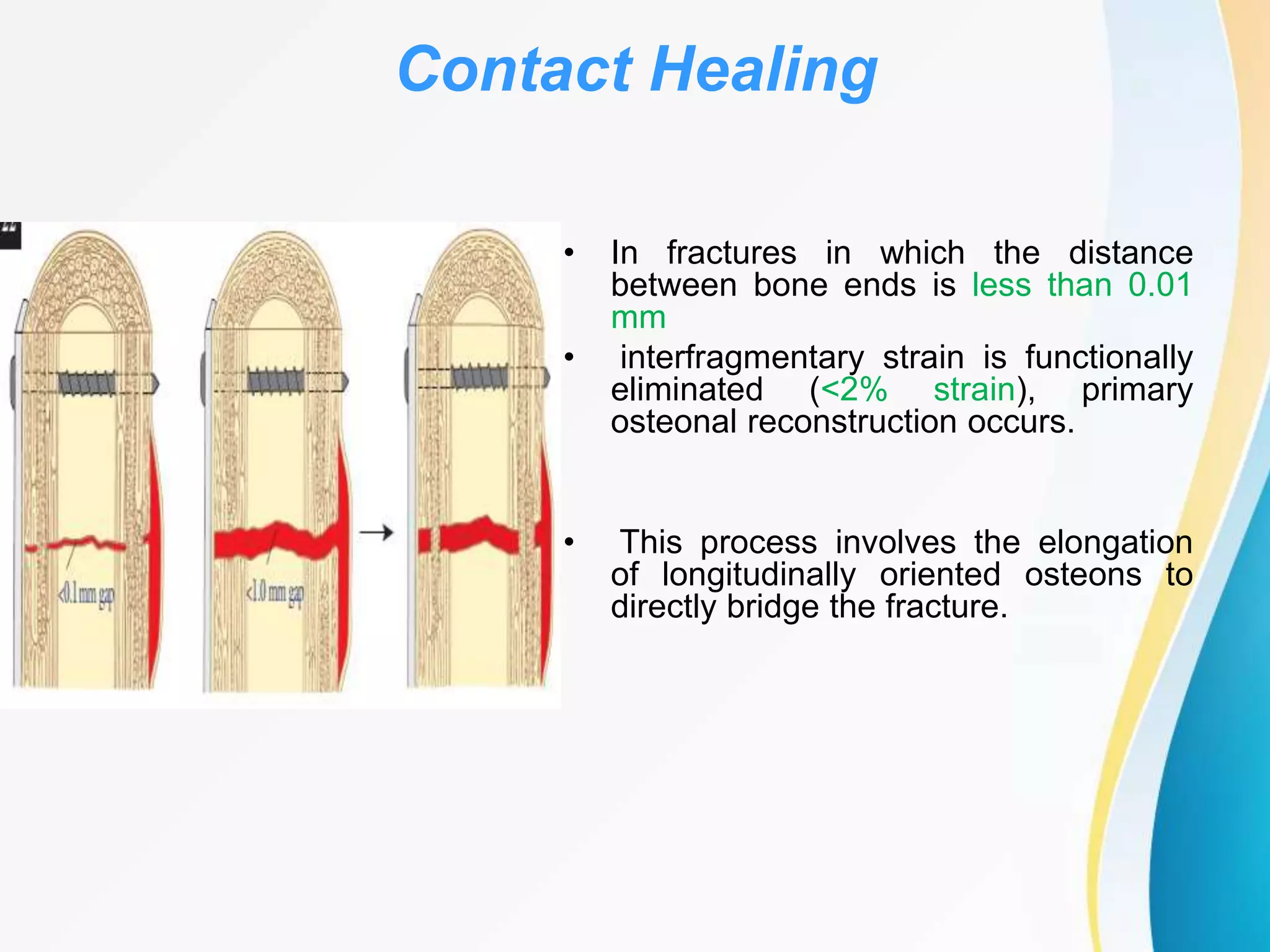 Fracture Healing.pptx
