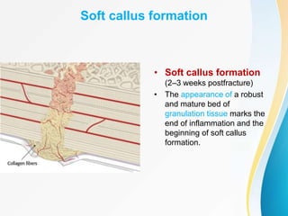 Fracture Healing.pptx