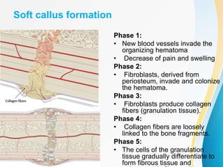 Fracture Healing.pptx