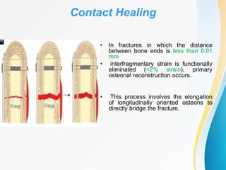 Fracture Healing.pptx