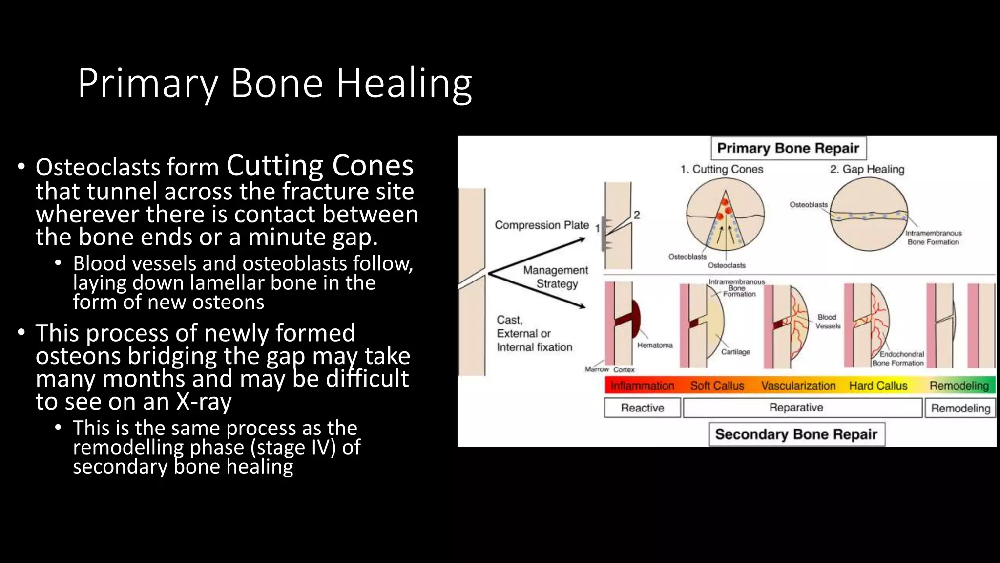 Fracture Healing.pptx