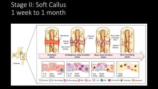 Fracture Healing.pptx