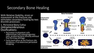 Fracture Healing.pptx