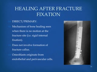 Fracture Healing.pptx
