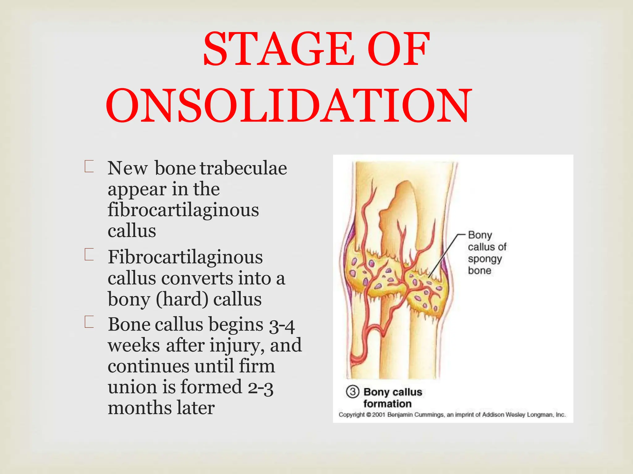 fracture healing.pdf traumatology mbbs md | PDF