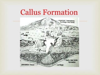fracture healing.pdf traumatology mbbs md | PDF