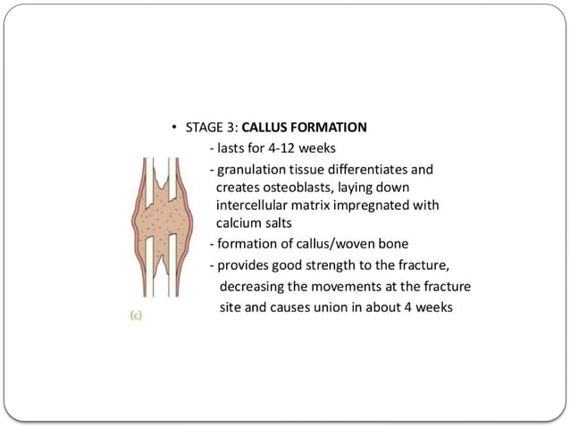 Fracture Healing in clinical orthopedics | PPTX