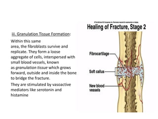 Fracture healing and wound healing | PPTX