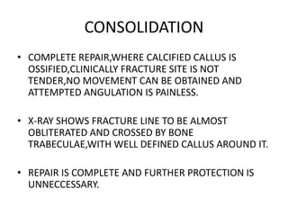 Fracture healing by dr.v.r.vignesh | PPTX