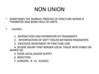 Fracture healing by dr.v.r.vignesh | PPT