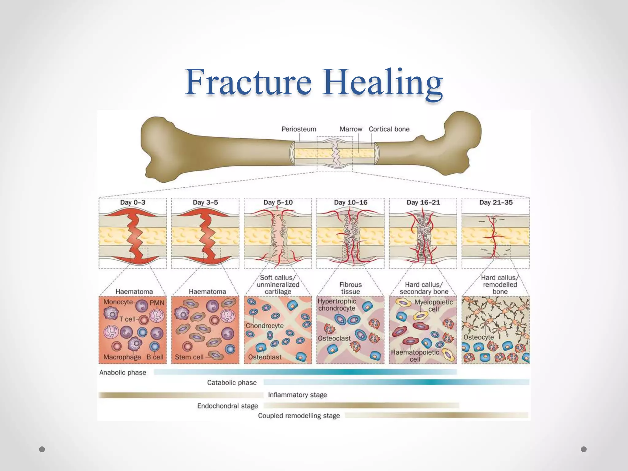 Fracture healing, complication & factors promotes the fracture healing ...