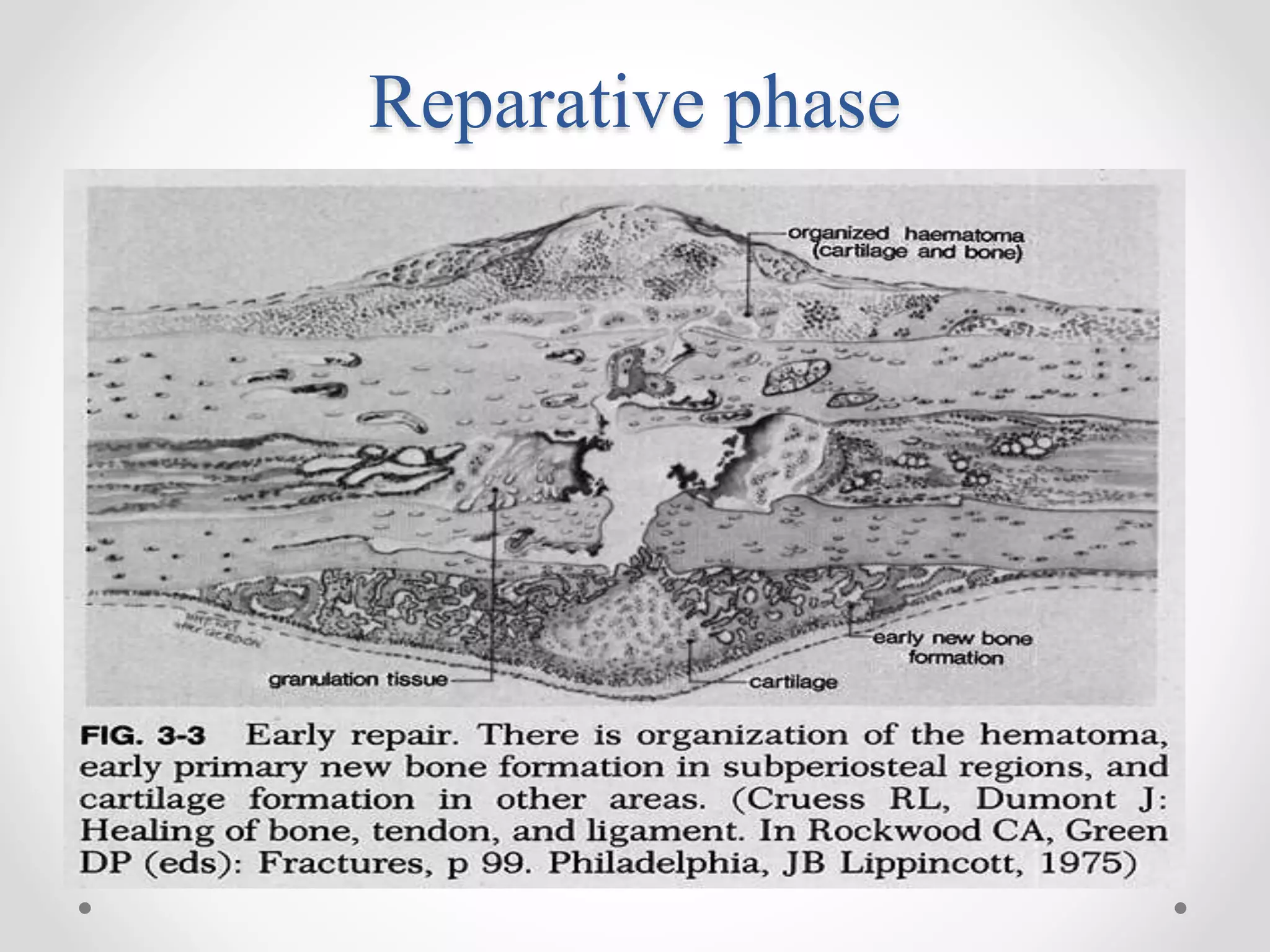 Fracture healing, complication & factors promotes the fracture healing ...