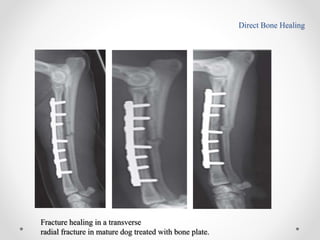 Fracture healing, complication & factors promotes the fracture healing ...