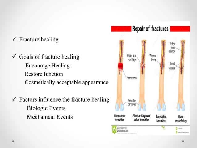 Fracture healing, complication & factors promotes the fracture healing ...