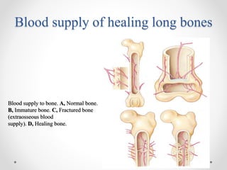 Fracture healing, complication & factors promotes the fracture healing ...