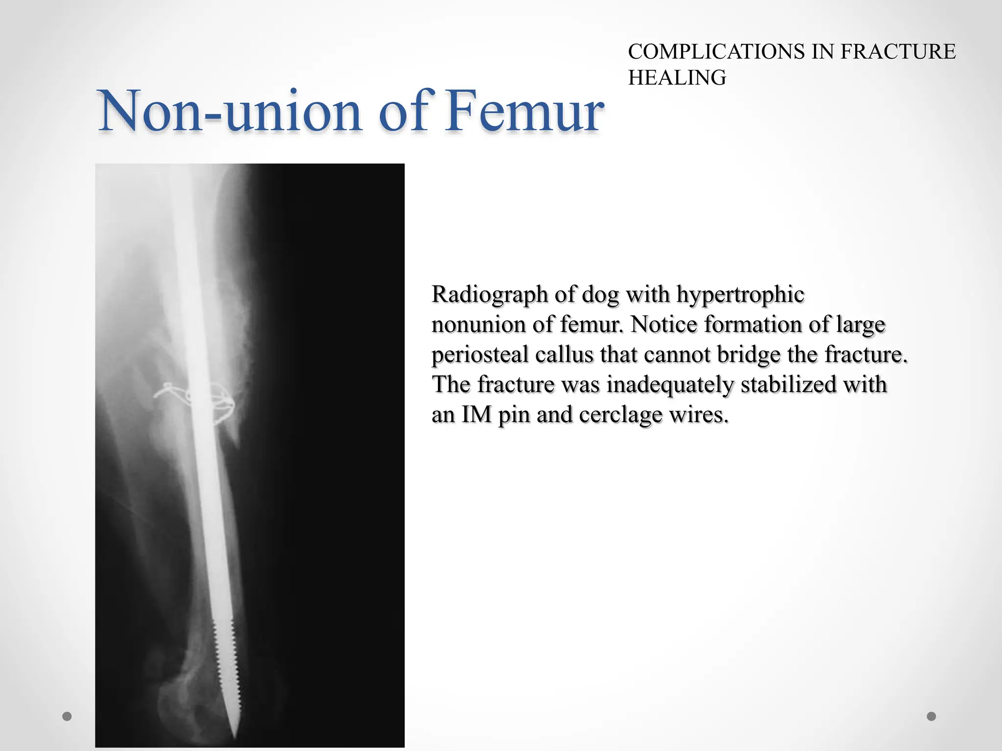 Fracture Healing, Complications & factors promotes the fracture healing ...