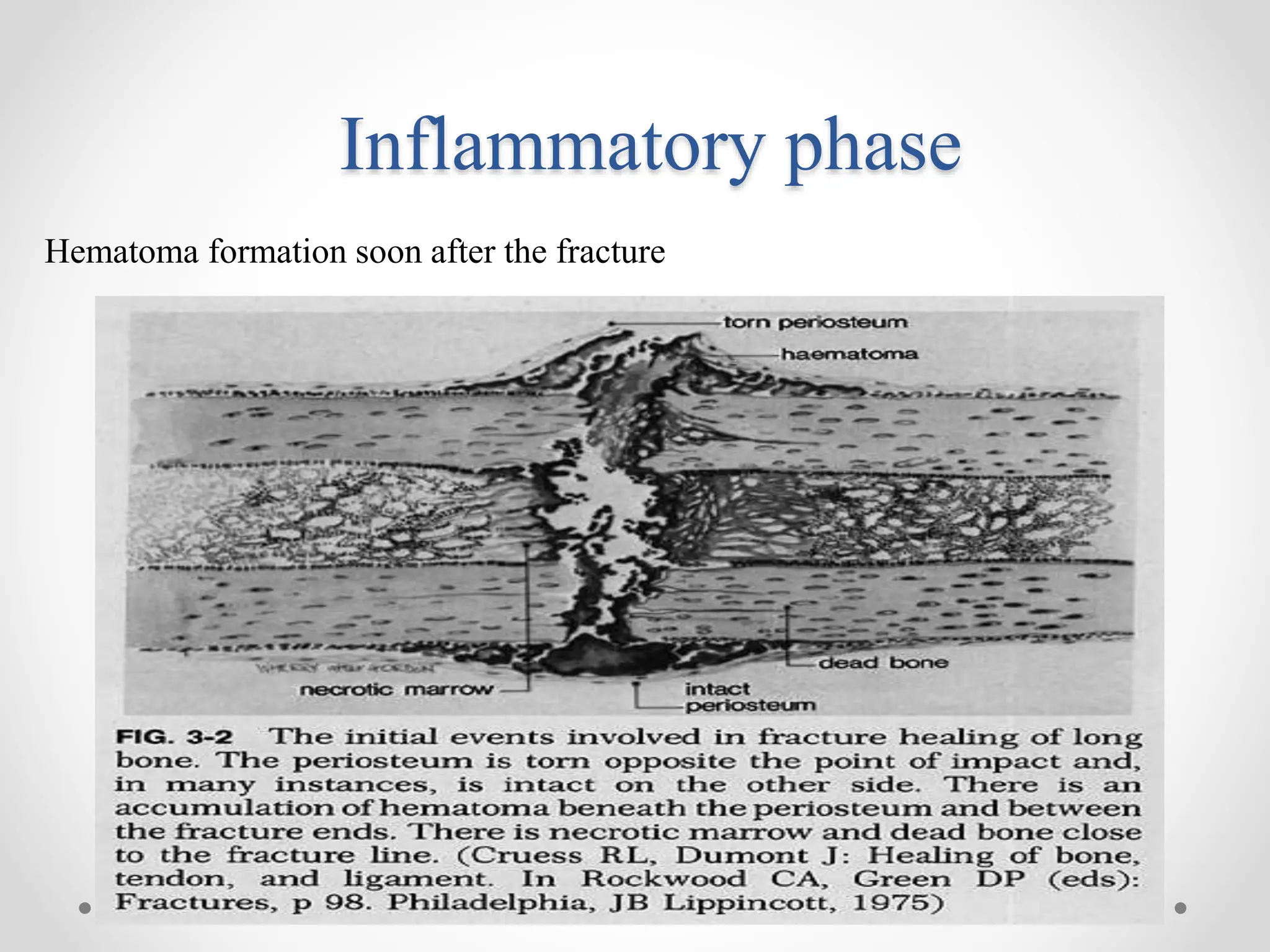 Fracture Healing, Complications & factors promotes the fracture healing ...